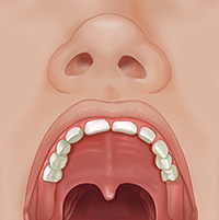 Normal Soft Palate